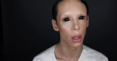 Gastó millones de dólares para convertirse en un alien: ¿cómo luce ...